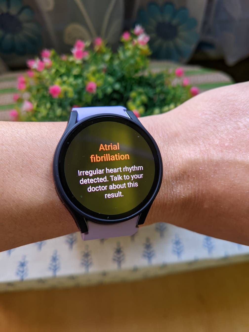 Atrial Fibrillation Detected by Samsung Galaxy Wat... - Samsung Members